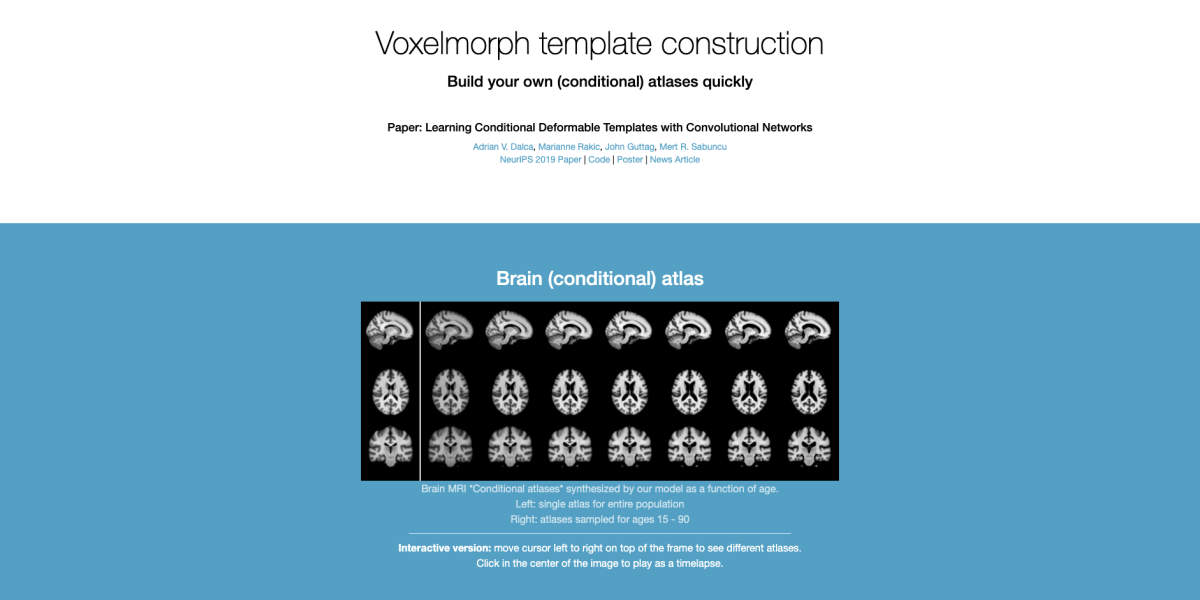 VoxelMorph：基于深度学习的医学图像配准框架 - 懂AI