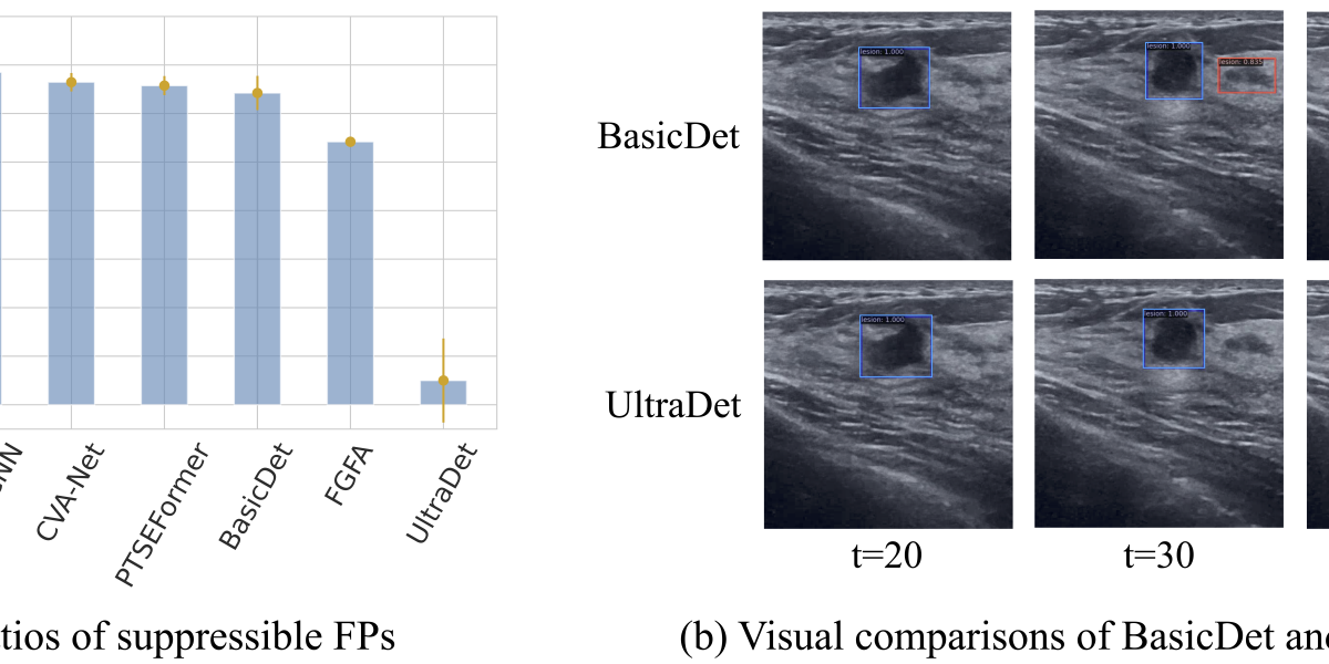 UltraDet: 实时超声病变检测的突破性技术 - 懂AI